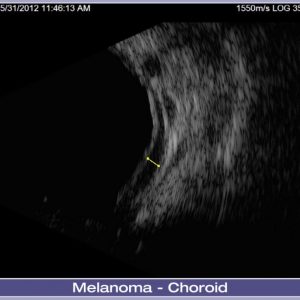 Eye-Cubed – Ophthalmic Singapore