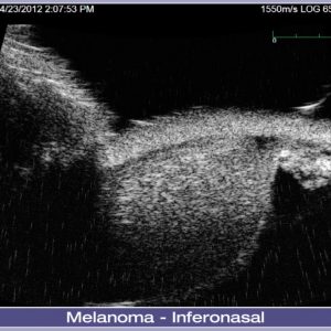 Eye-Cubed – Ophthalmic Singapore