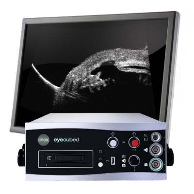 Ultrasound – Ophthalmic Singapore