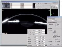 OCULUS Pentacam® – Ophthalmic Singapore