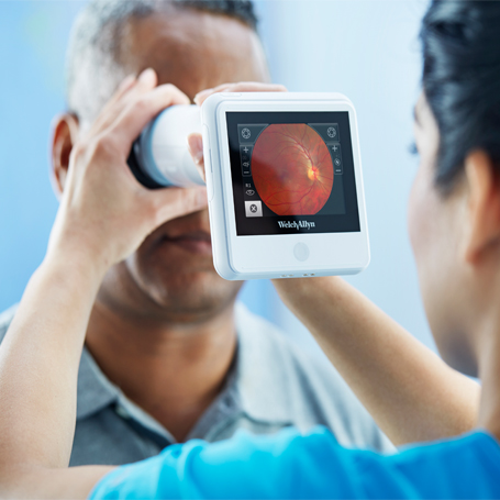 RetinaVue® 100 Imager – Ophthalmic Singapore