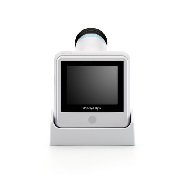 RetinaVue® 100 Imager – Ophthalmic Singapore