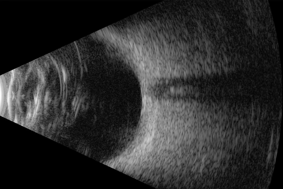 Eye One – Ophthalmic Singapore